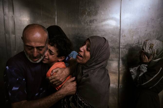 Gaza Father Mourns Child Lost to Malnutrition, Fights to Save Remaining ...